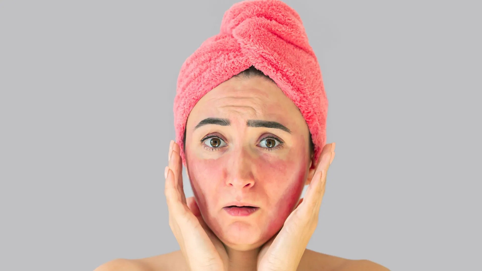 How to Get Rid of Red Spots on Face Quickly: Natural Home Remedies ...